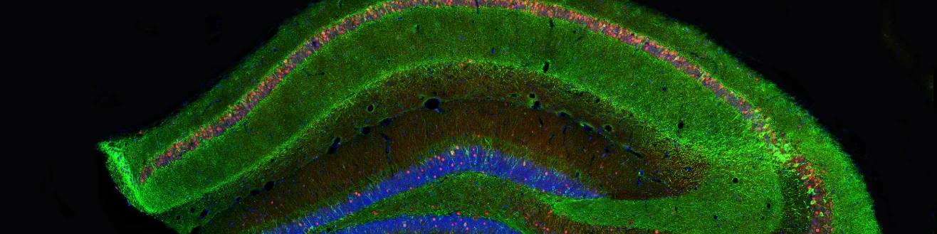 Australian Institute for Microbiology & Infection (AIMI) | University ...